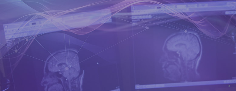 Brain Tumor SPORE: Robert H. Lurie Comprehensive Cancer Center of ...