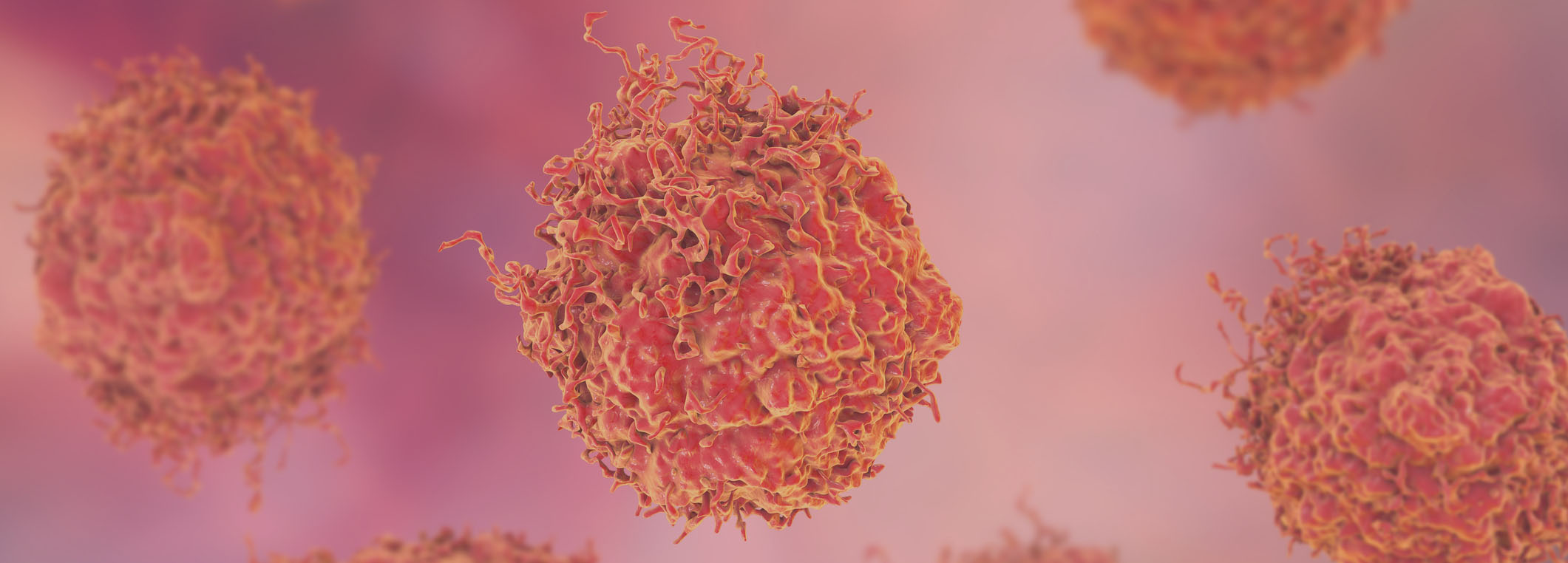 Prostate Cancer SPORE: Robert H. Lurie Comprehensive Cancer Center of ...