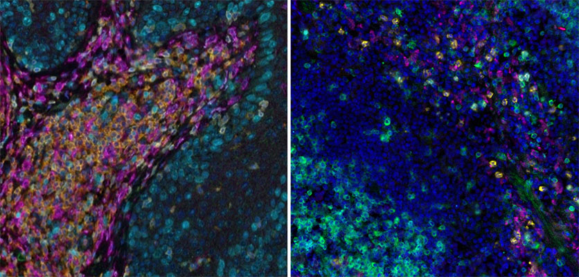 Immunotherapy Assessment Core: Robert H. Lurie Comprehensive Cancer ...