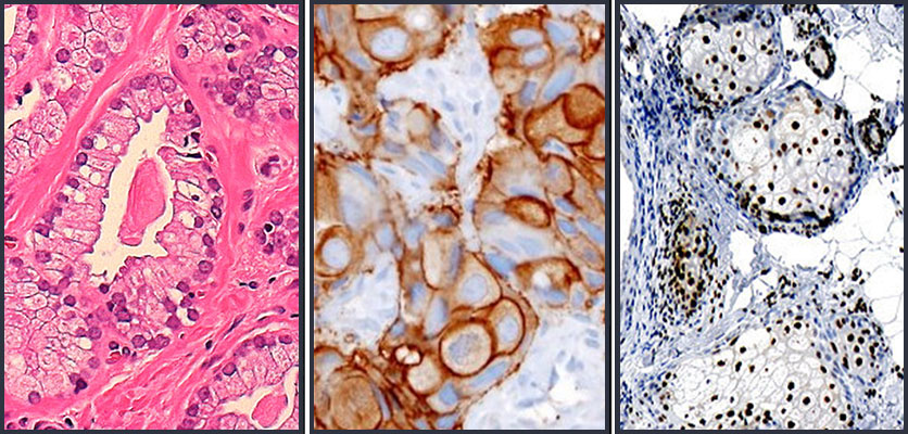 Pathology Core Facility: Robert H. Lurie Comprehensive Cancer Center of ...